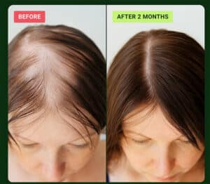 Halo Grow Hair Spray Erfahrungen ⚜️ Wirkt es wirklich?